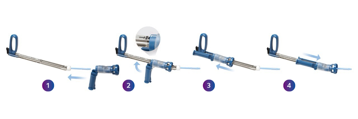 RUMI Ⅱ システム – クーパーサージカル・ジャパン株式会社 メディカルデバイス